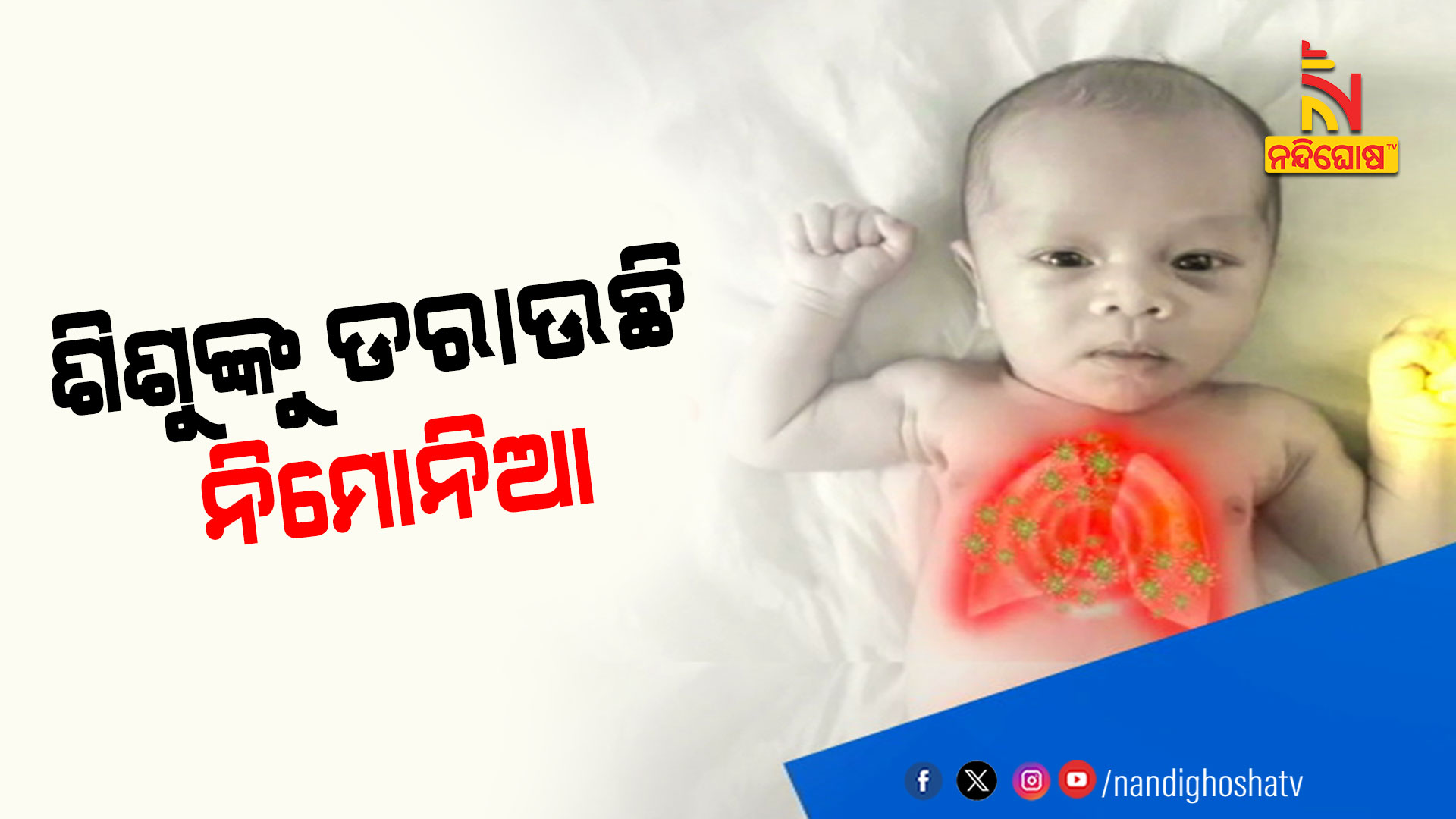 ଶିଶୁଙ୍କୁ ନିମୋନିଆରୁ ରକ୍ଷା ପାଇଁ କଣ କରିବେ